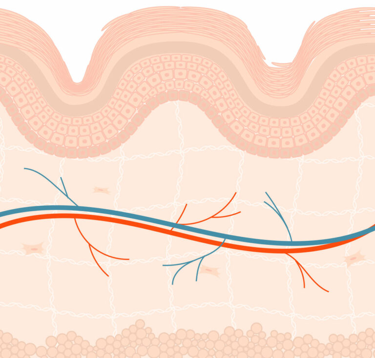 Aging skin - Tience